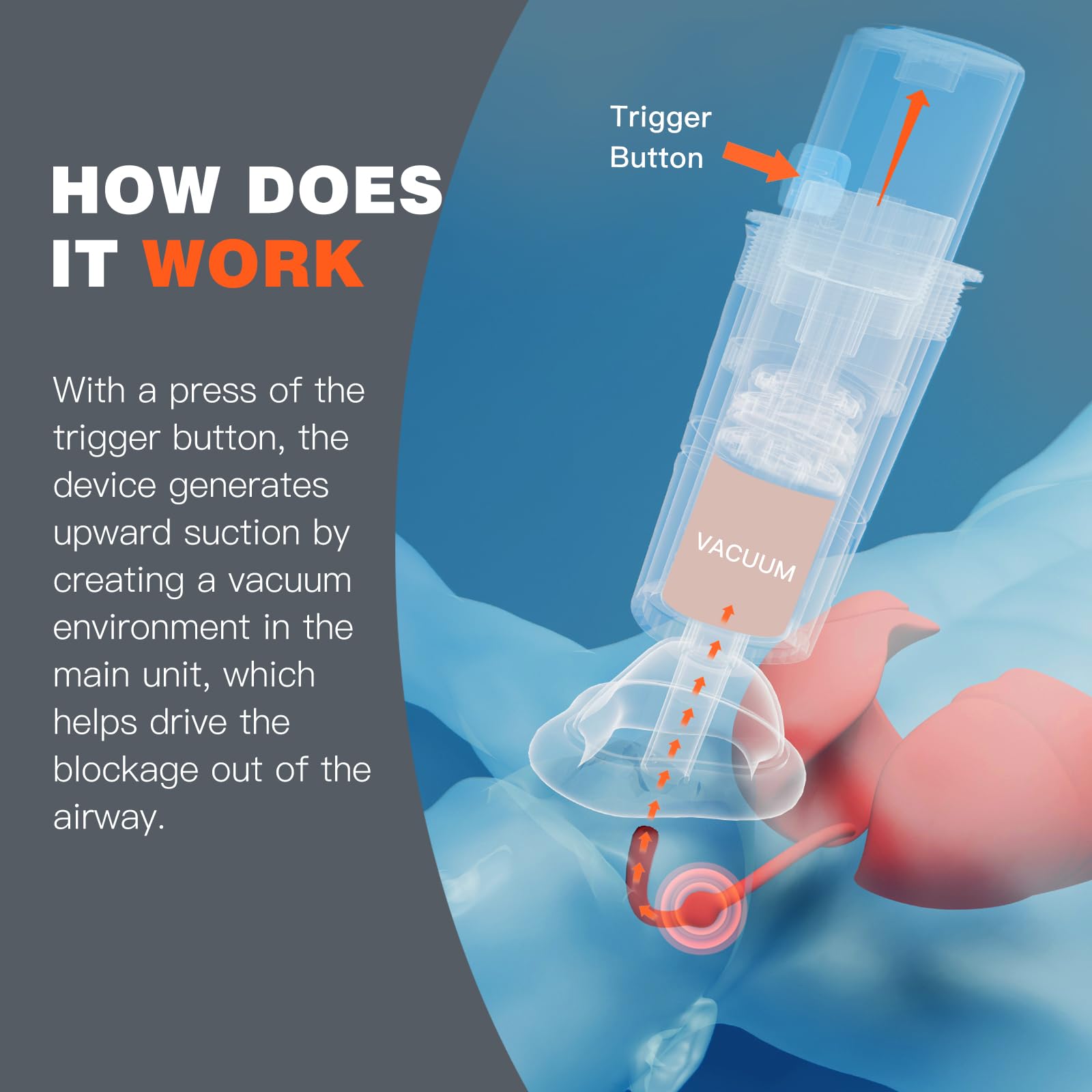 Mua Automatic Choking Rescue Device for Kids and Adults with 3 Masks ...