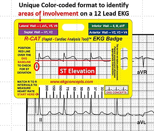 R-CAT EKG Badge Card – Accurately Interpret ECG/EKG Rhythm Strips and ...