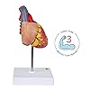 Axis Scientific Heart Model, 2-Part Deluxe Life Size Human Heart ...