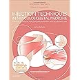 Injection Techniques in Musculoskeletal Medicine: A Practical Manual ...