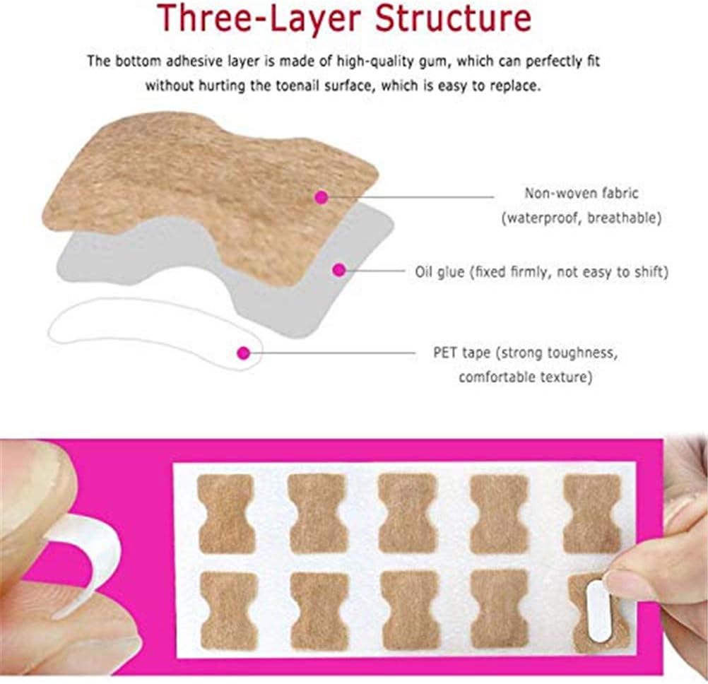Ingrown Toenails Stickers, 50PCS Glue-Free Toenail Correction Patch ...