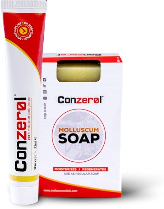 Conzerol. Cream and Soap Molluscum Treatment Kit: Amazon.co.uk: Health ...