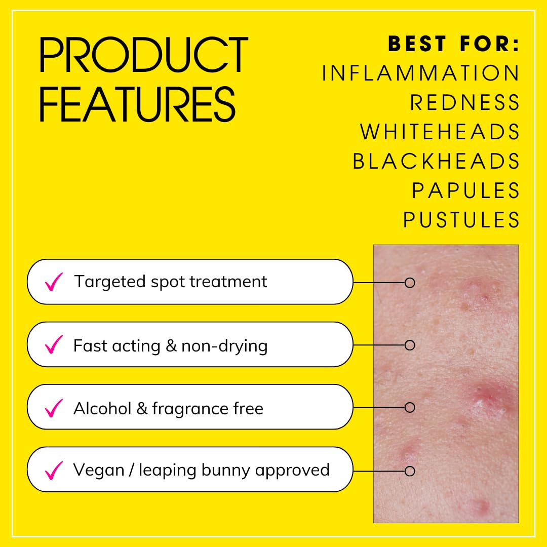 Mua Clear Skin Days 2% Niacinamide, 2% Salicylic Acid, & 1% Zinc Spot ...