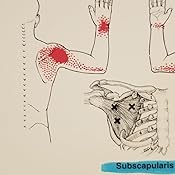 Travell and Simons' Trigger Point Flip Charts: 9780683180084: Medicine ...