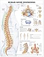 Amazon.com: Human Spine Disorders Anatomical Chart: Industrial & Scientific