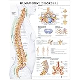 Amazon.com: ACC Human Spine Disorders Anatomical Chart : Anatomical ...