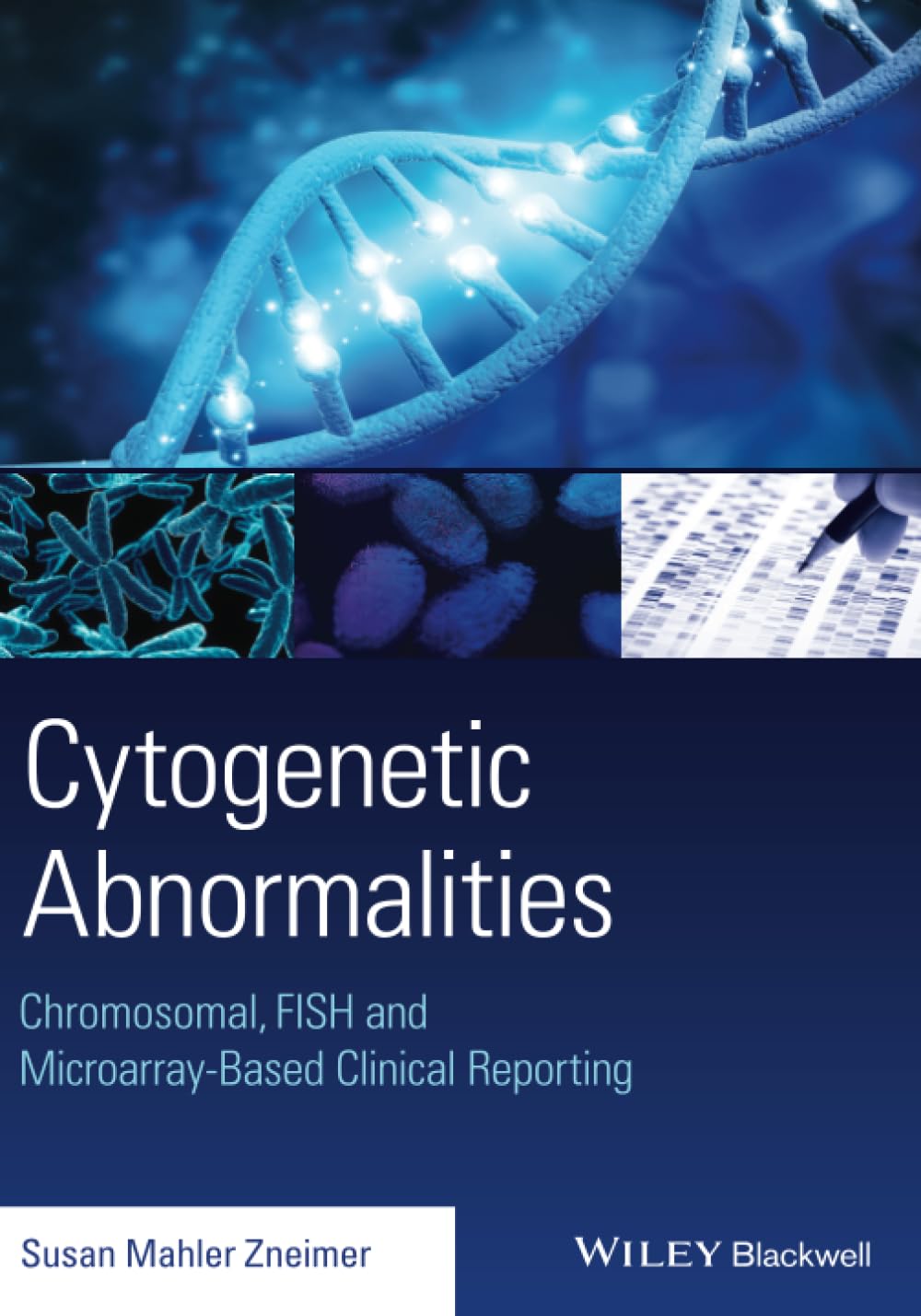 Mua Cytogenetic Abnormalities: Chromosomal, FISH and Microarray-Based ...