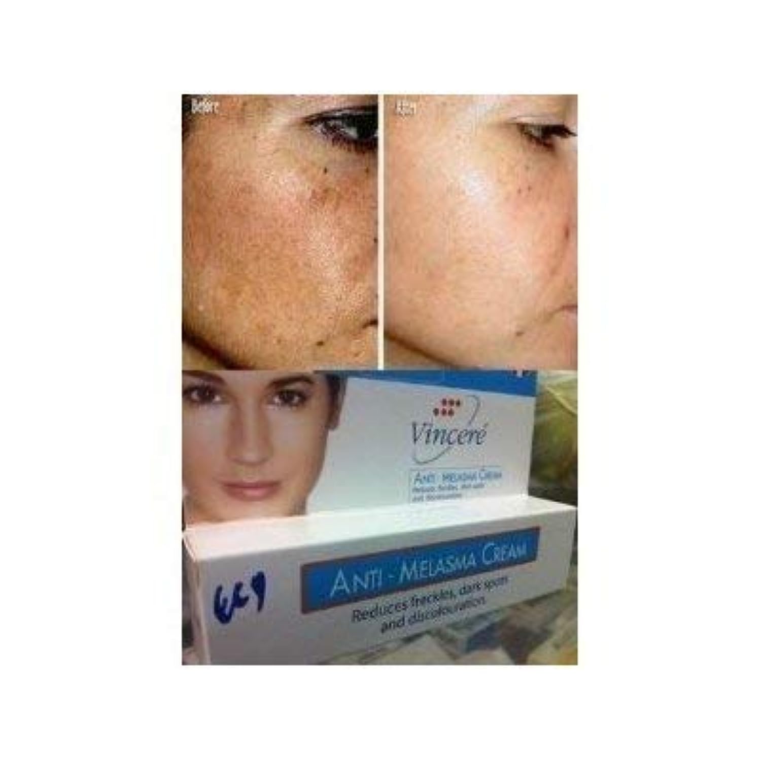 Anti Melasma Cream shop Kuwait | Buy Anti Melasma Cream products online ...