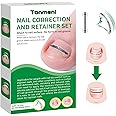 Amazon.com: Titanium Alloy Silicone Ingrown Toenail Treatment, Designed ...