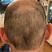 Philips Series 9000 Hair Clipper for Ultimate Precision with 400 Length ...