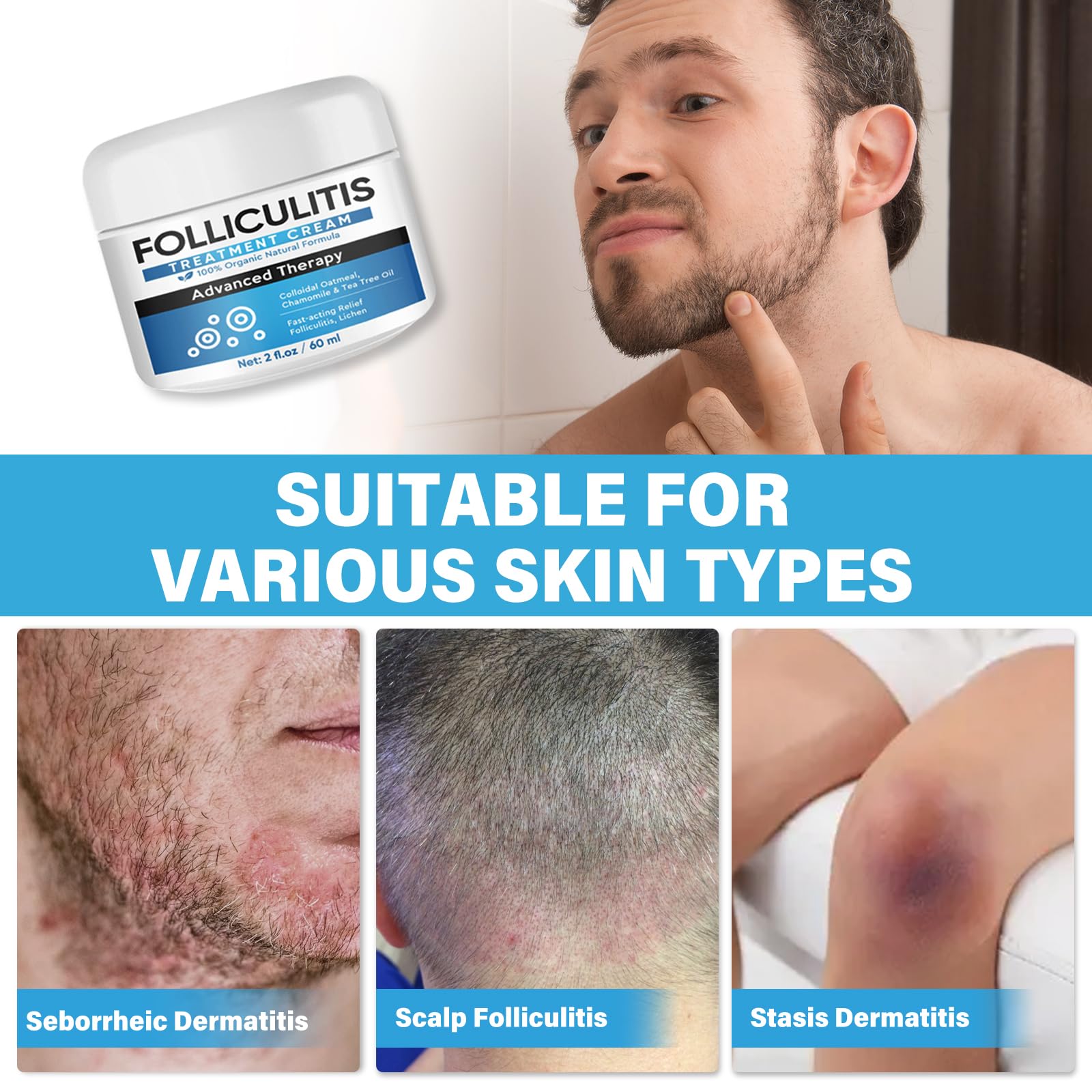 Mua ALSTEN Folliculitis Treatment, Upgrade Folliculitis Cream, Fast ...