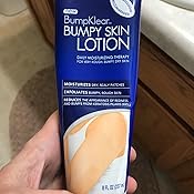 Amazon.com: BumpKlear Bumpy Skin Lotion - Rich Moisturizing Cream for ...