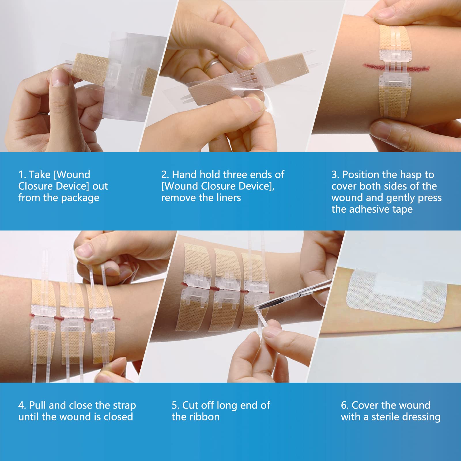 Mua Zip Stitch Wound Closure Kit, Butterfly Bandages,Quick Clot for ...