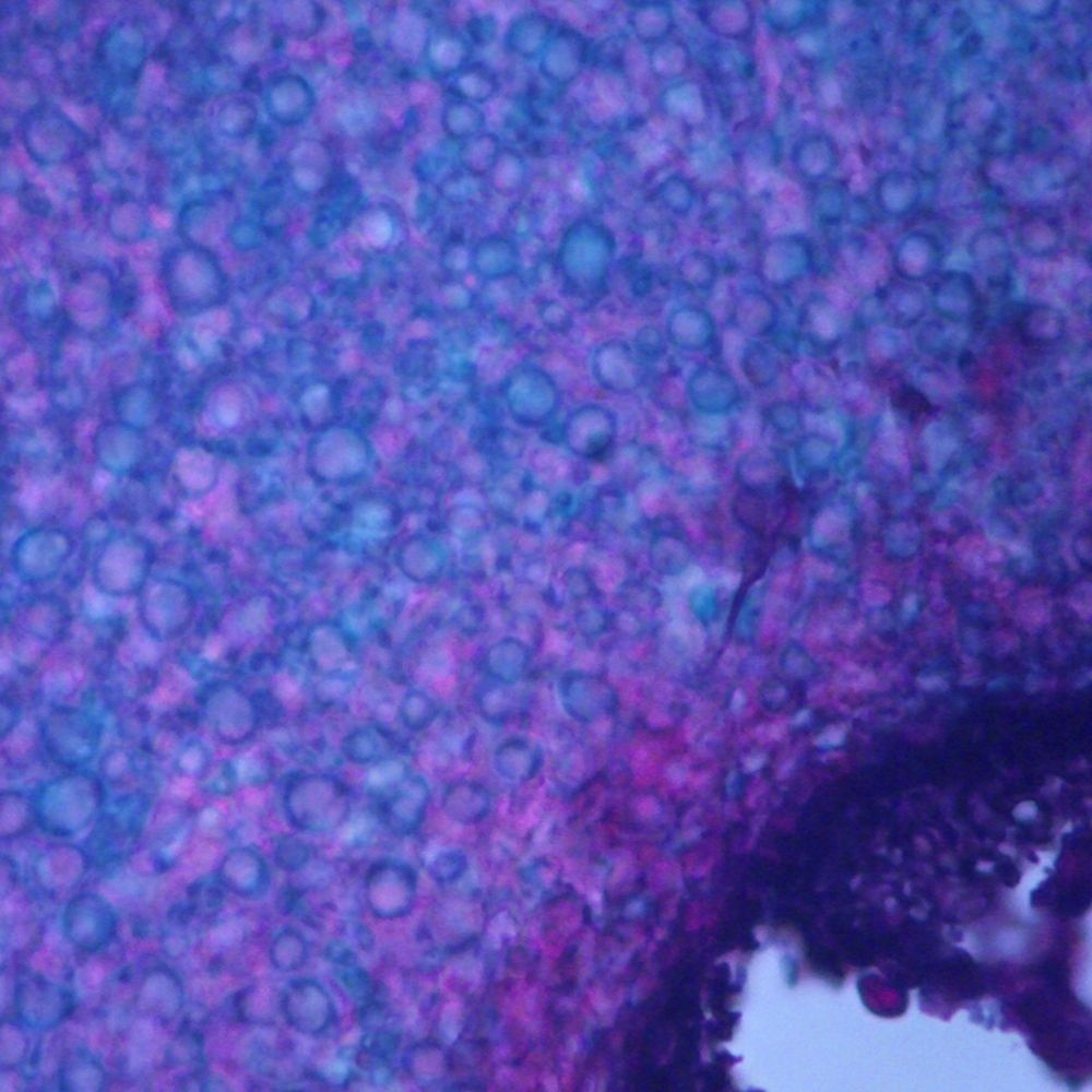 12 m Microscope Slide Claviceps purpurea Mature Sclerotium c.s ...