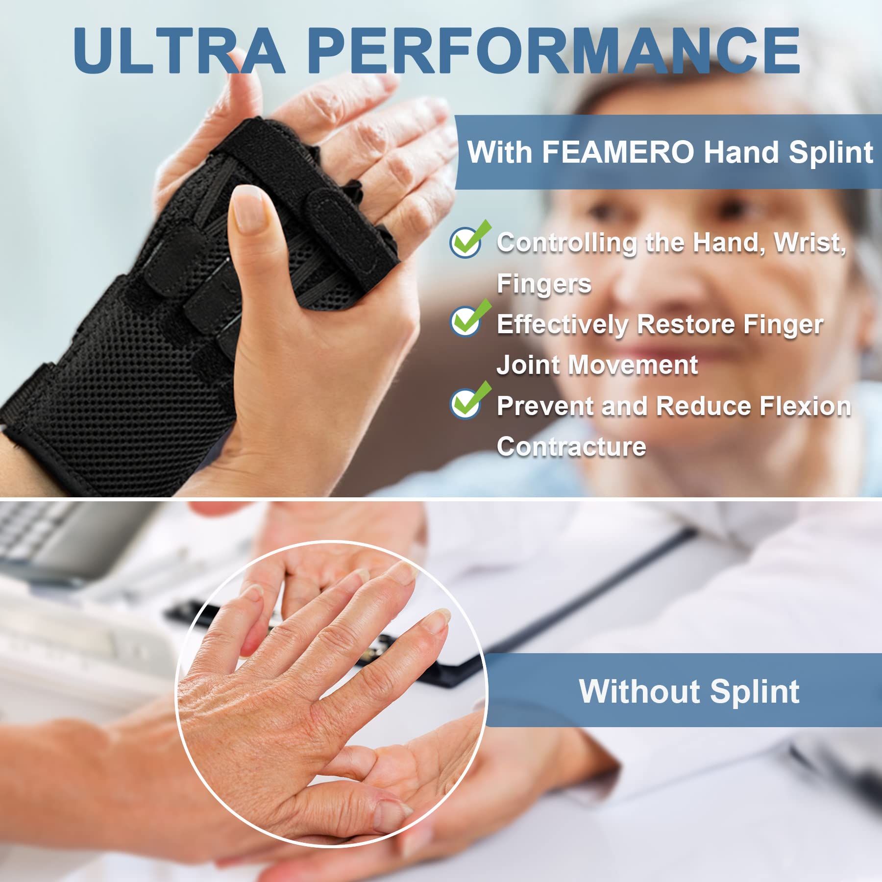 Mua Feamero Radial Nerve Palsy Splint, Adjustable Finger Lift Elastic ...