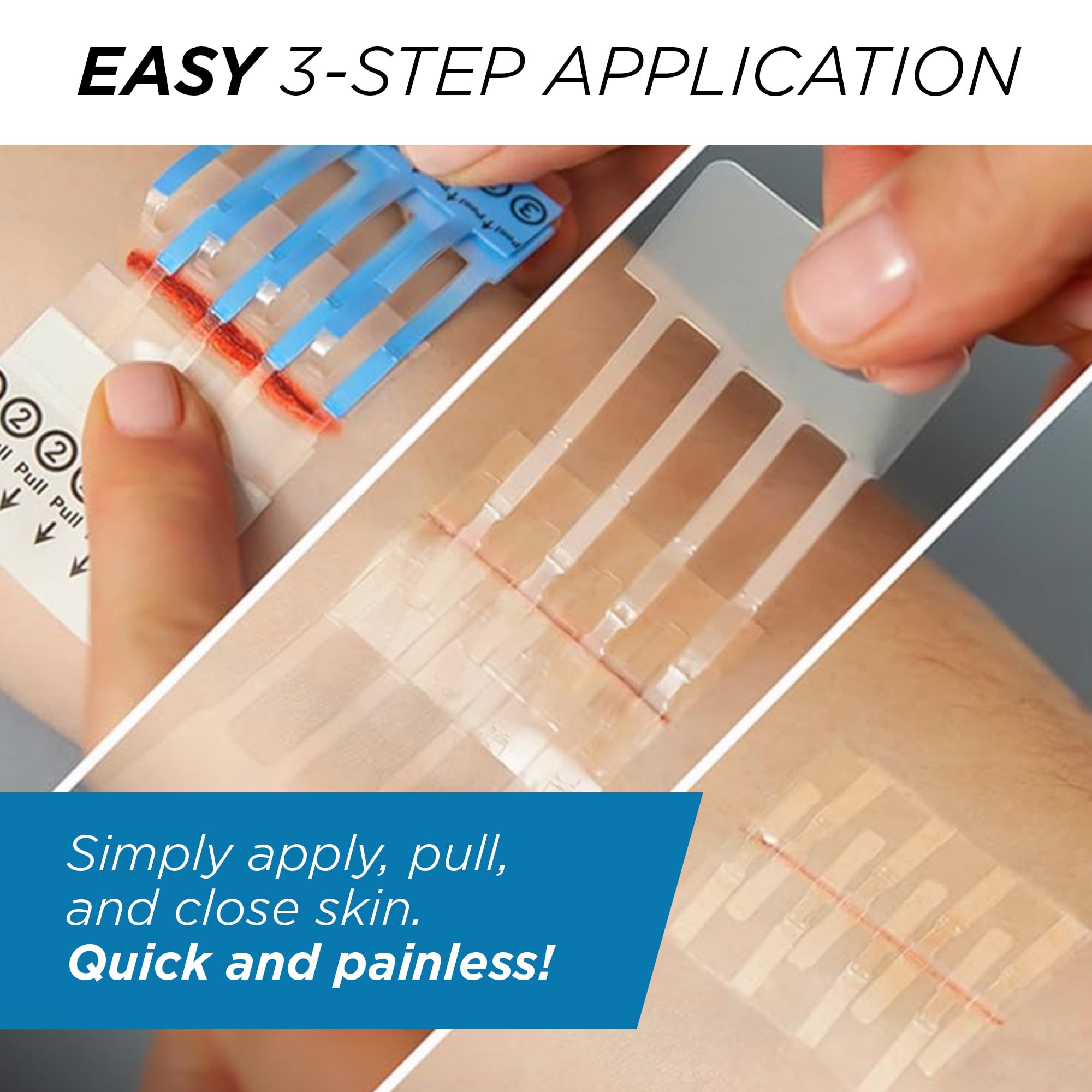 Mua Clozex Emergency Laceration Kit - Repair Wounds Without Stitches. FDA Cleared Skin Closure ...