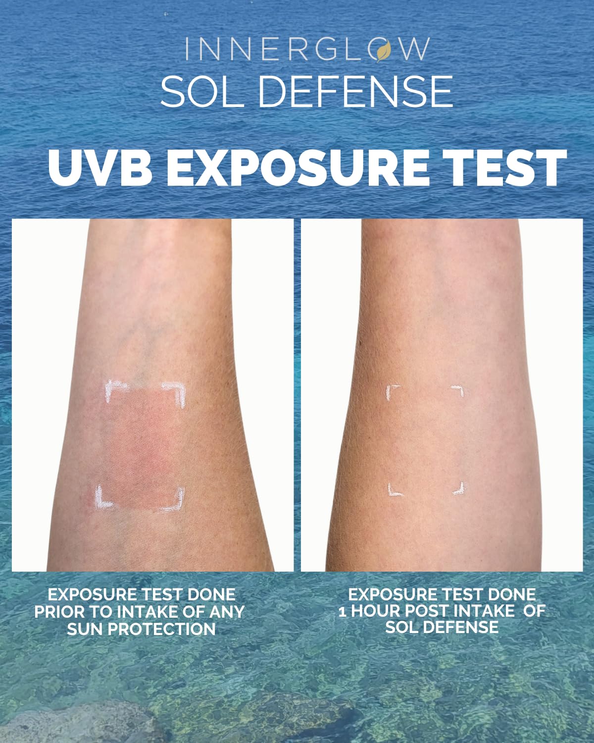 Mua Inner Glow Sol Defense Gummies - Dermatologist and Plastic Surgeon ...