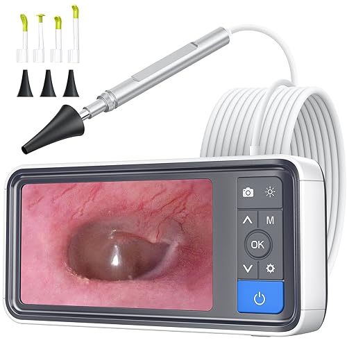 ScopeAround Otoscope Ear Camera with 4.5" IPS Screen, FHD Digital ...