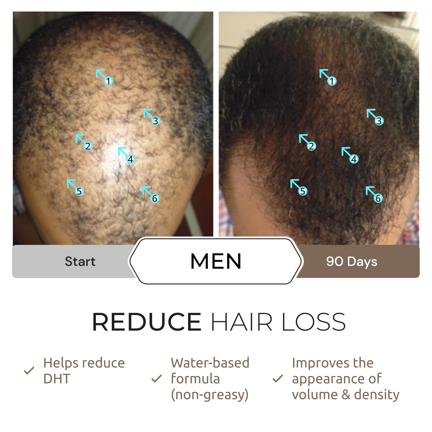 Retinol For Hair Loss at Isaac Perdriau blog