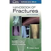 Handbook of Fractures: 9781451193626: Medicine & Health Science Books ...
