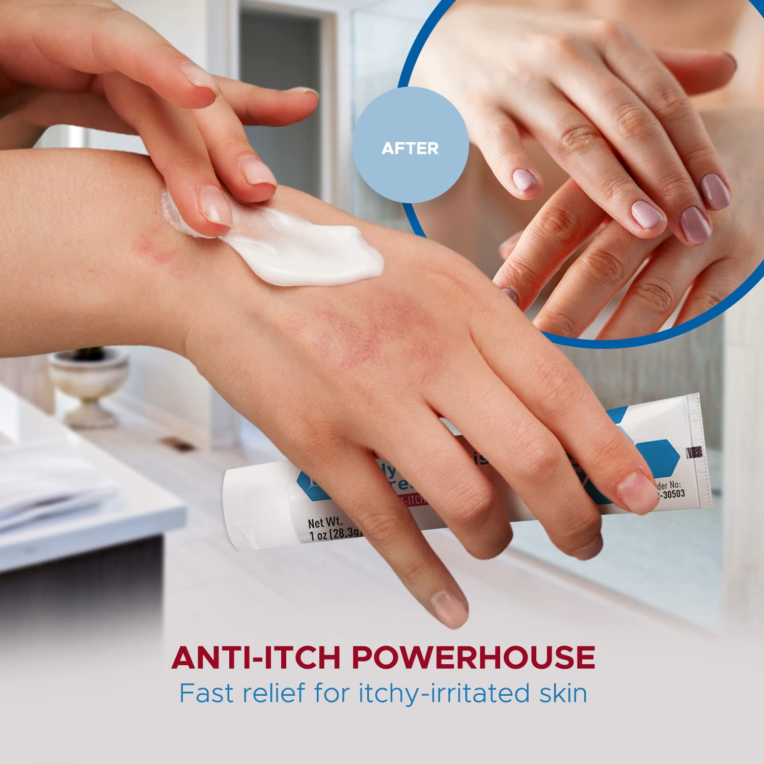 Mua MED PRIDE Hydrocortisone Cream 1%| Pack of 4, 1 Oz Tubes | Anti ...