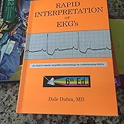 Rapid Interpretation of EKG's, Sixth Edition: Dubin, Dale ...