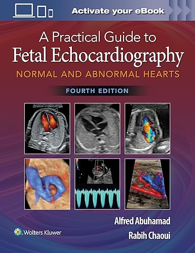 A Practical Guide to Fetal Echocardiography: Normal and Abnormal Hearts in Kuwait | Whizz ...