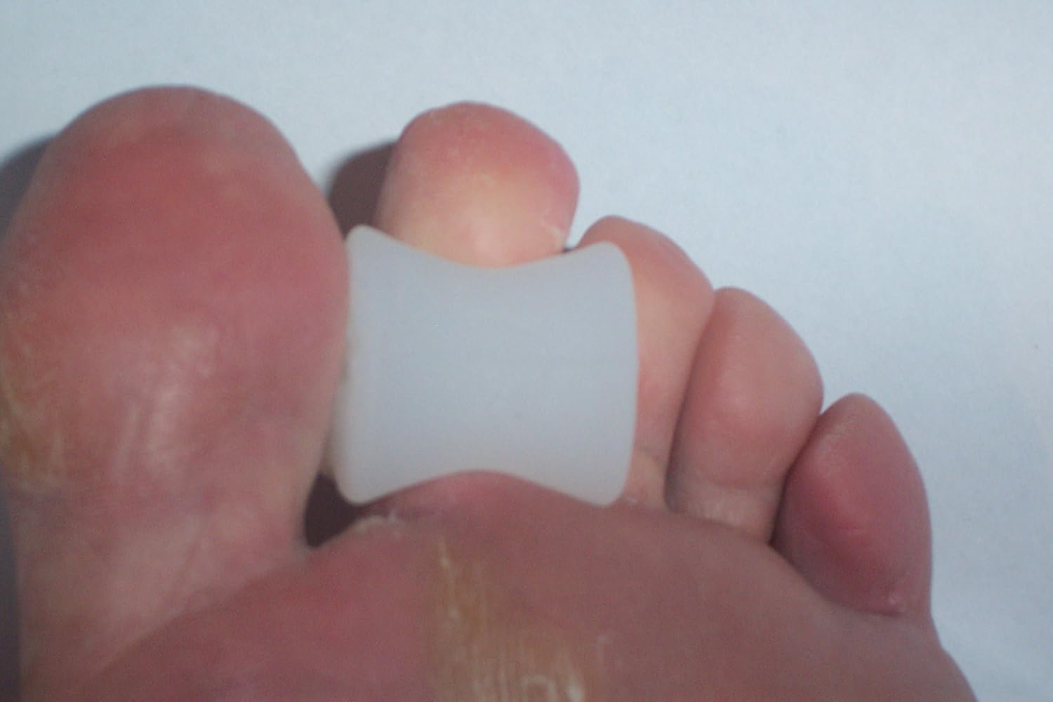 x4 FootTrekTM Soft Polymer Silicone Gel Toe Props/ Supports ...