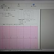 Amazon | オムロンHCG-801用 心電図印刷ソフト HCG-SOFT-2 | オムロン(OMRON) | 健康家電