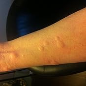 Aerius Allergy Medicine, Fast Relief, 24-Hour, Non-Drowsy, 15 Symptoms ...