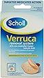 Scholl Freeze Verruca and Wart Remover, 80ml: Amazon.co.uk: Health ...