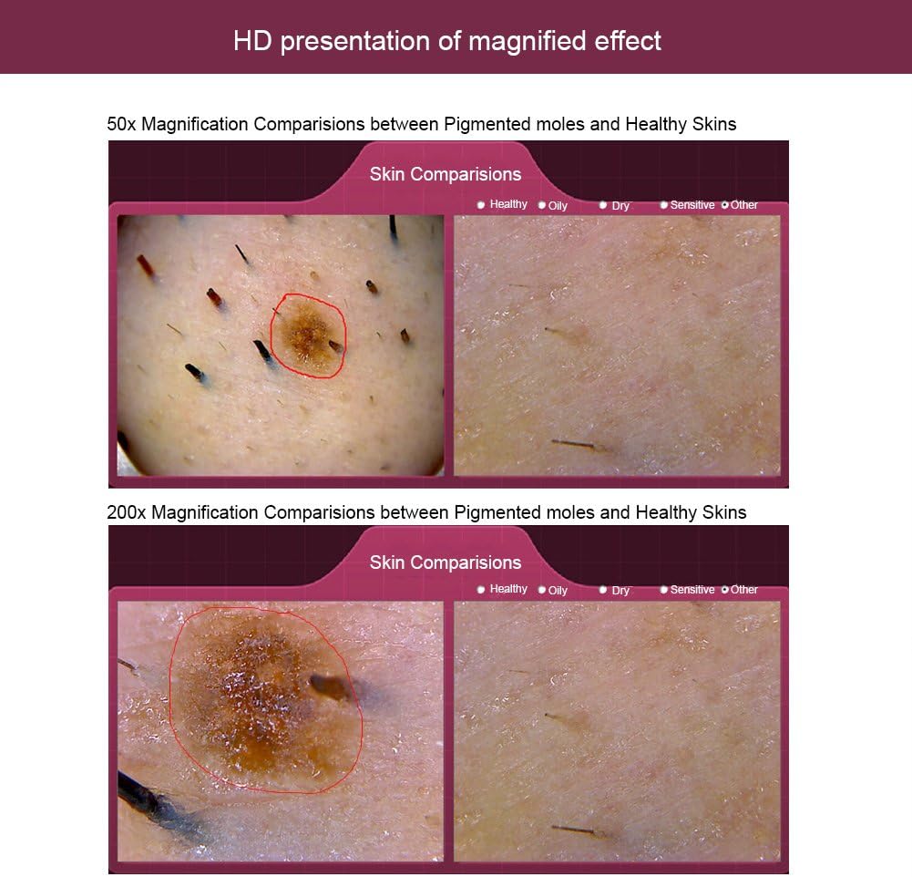 Digital Microscope,USB Skin Hair Scalp Detector Digital Microscope Skin ...