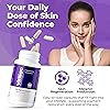 AURA VITAMINS - Vitiligo Capsules 60 Count | 1 Month | Improve Skin ...