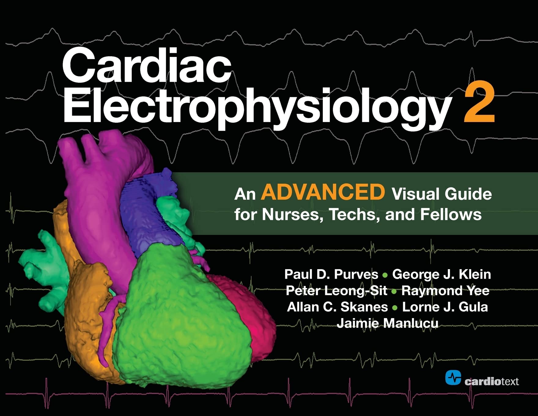 Mua Cardiac Electrophysiology 2: An Advanced Visual Guide for Nurses ...