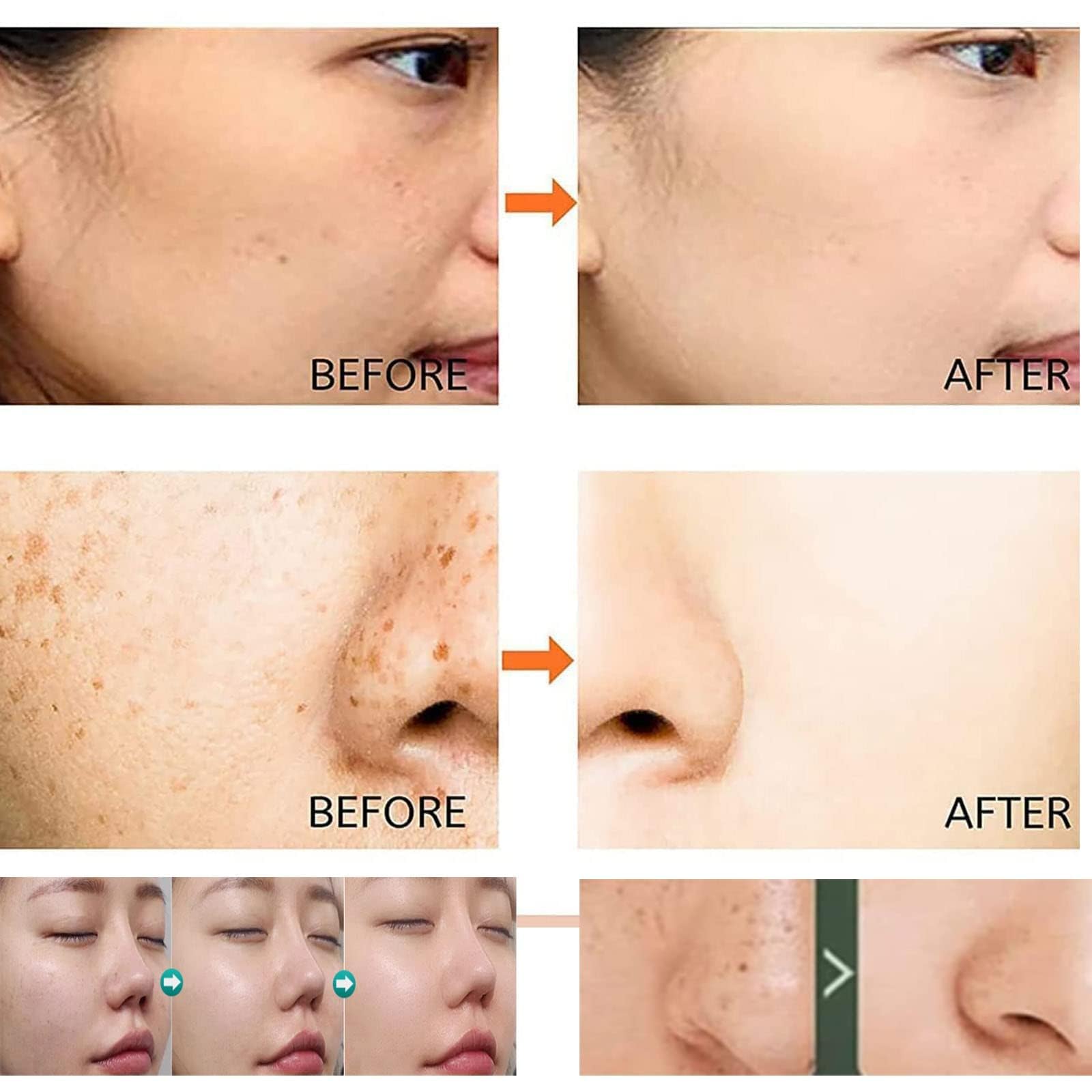 Mua Herizem Japanese Melasma Cream, Japanese Melasma Cream,Japanese ...