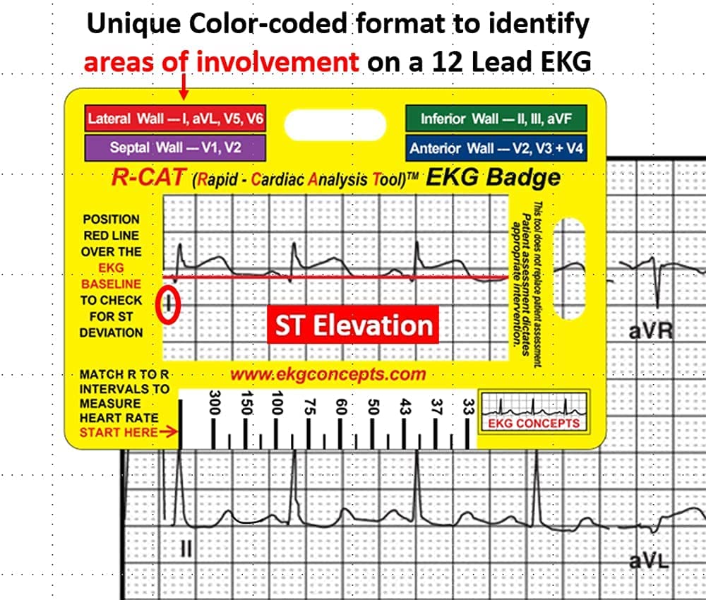 Mua R-CAT EKG Badge Card – Accurately Interpret ECG/EKG Rhythm Strips and 12 Lead EKG without ...