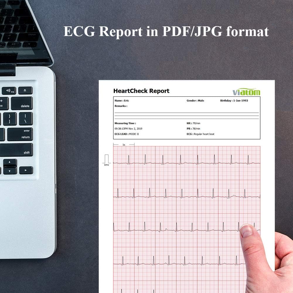 Wellue Checkme Lite Heart Monitor, Wireless Detection Device with SpO2 & EKG Tracking Function ...
