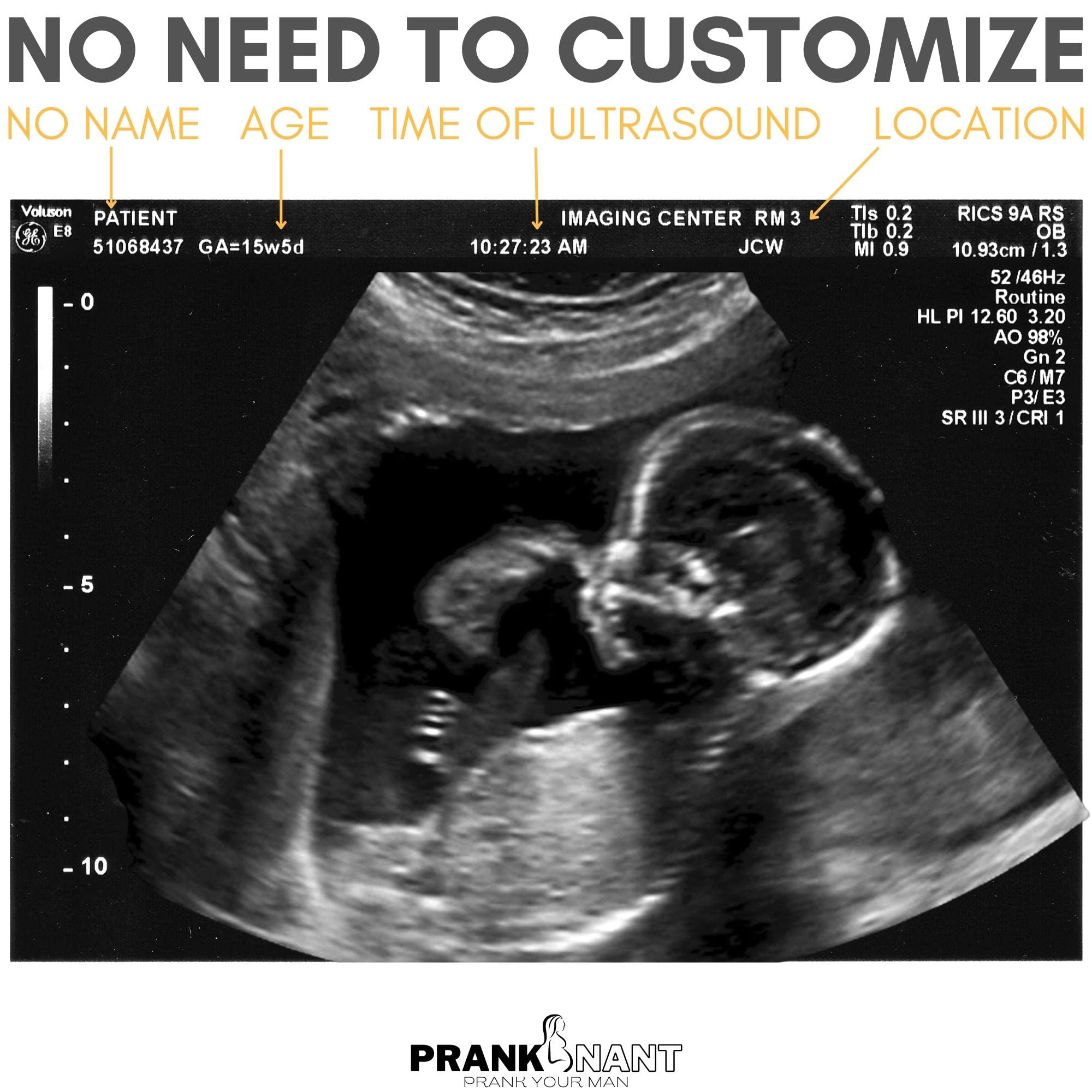 Mua Pranknant Fake Ultrasound Prank Pictures | 2D Strip of 3 Photos ...