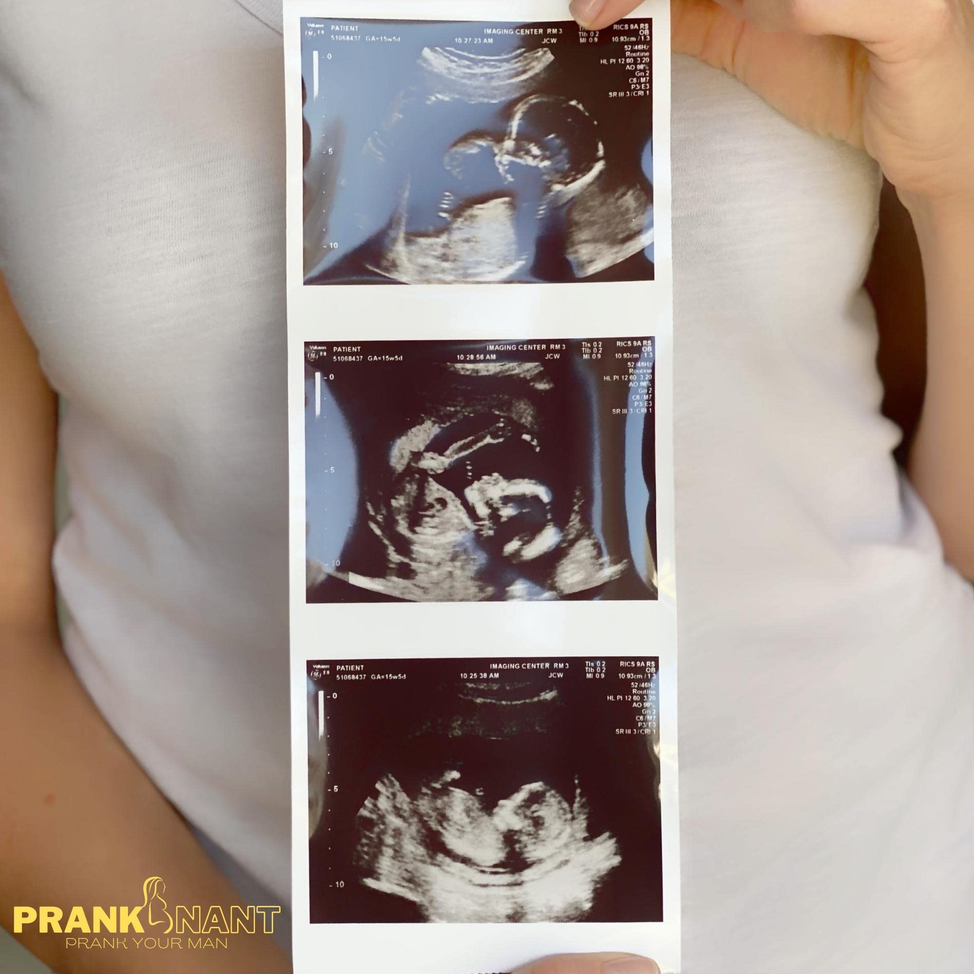 Mua Pranknant Fake Ultrasound Prank Pictures | 2D Strip of 3 Photos ...