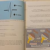 Rapid Interpretation of EKG's, Sixth Edition: Dale Dubin: 9780912912066 ...