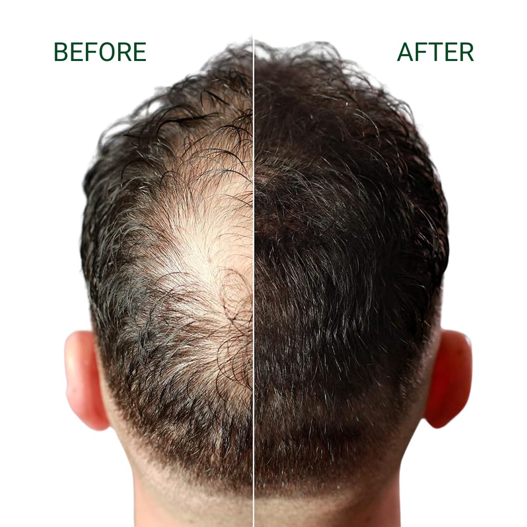 Mua FIBR Hair Keratin Building Fibers, Fill In Fine and Thinning Hair ...