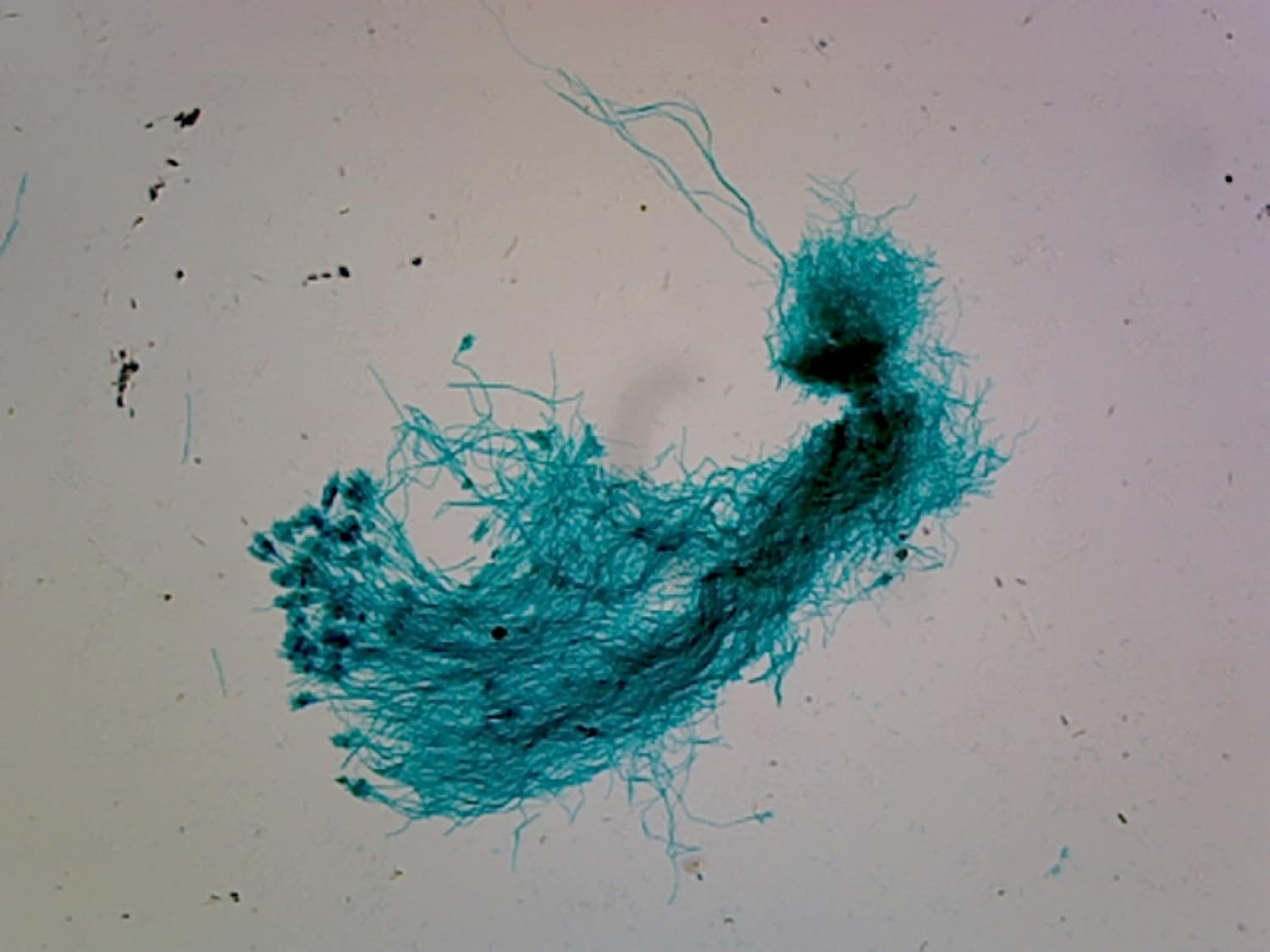 Penicillium Microscope Slide Ascomycetes tillescenter Microscope ...