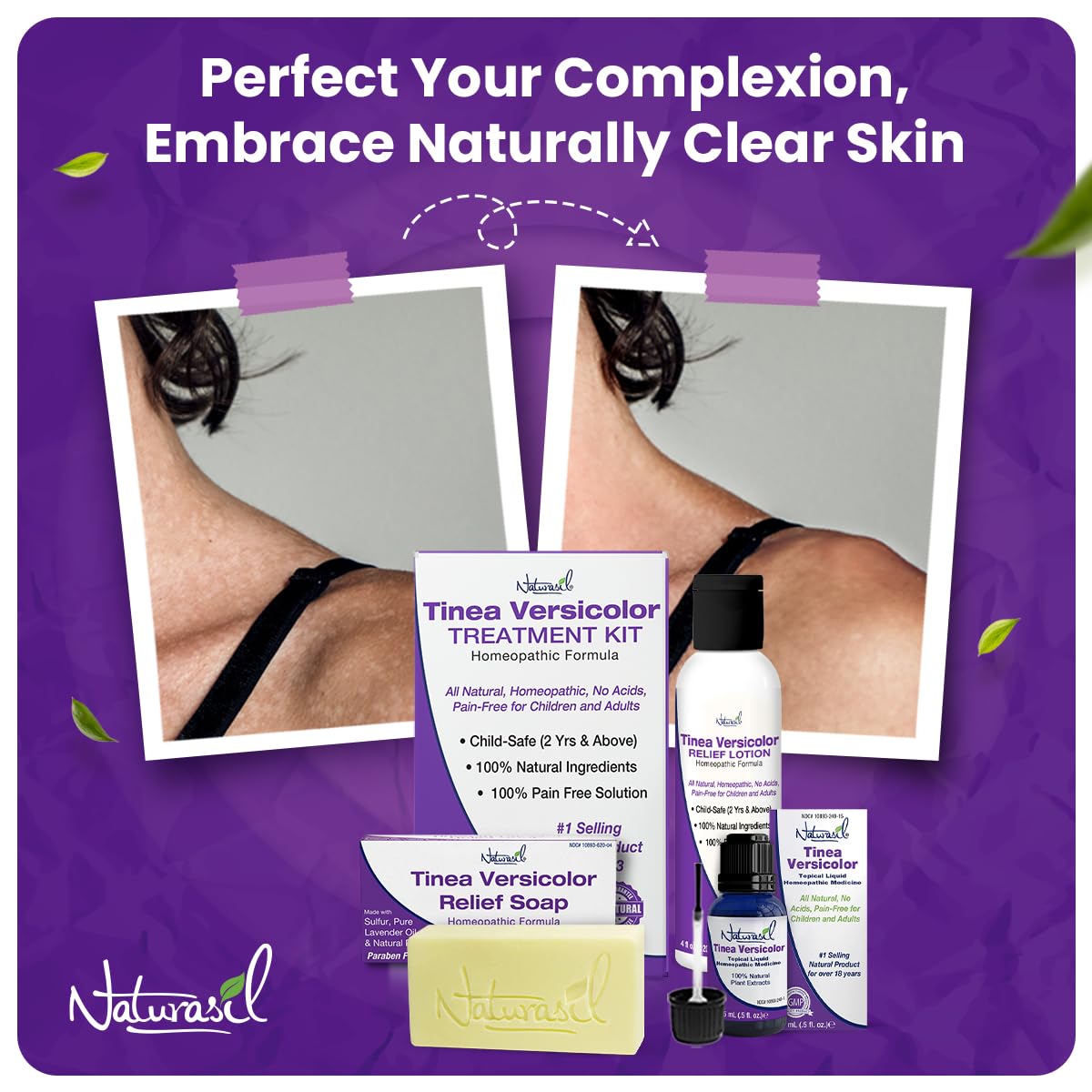Mua Naturasil Powerful Tinea Versicolor Treatment - Fast-Acting Tinea ...