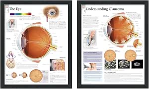 Amazon.com: Set of 2 Framed Medical Posters The Eye and Understanding ...