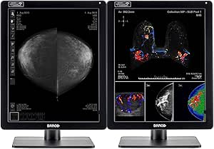 Amazon.com: Pair (x2) Barco Nio MDNC-6121 5MP 21'' Color LED Mammo 3D ...