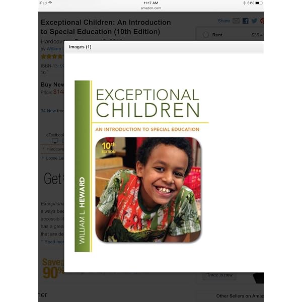 Exceptional Children 11 Unique Kids With Unusual