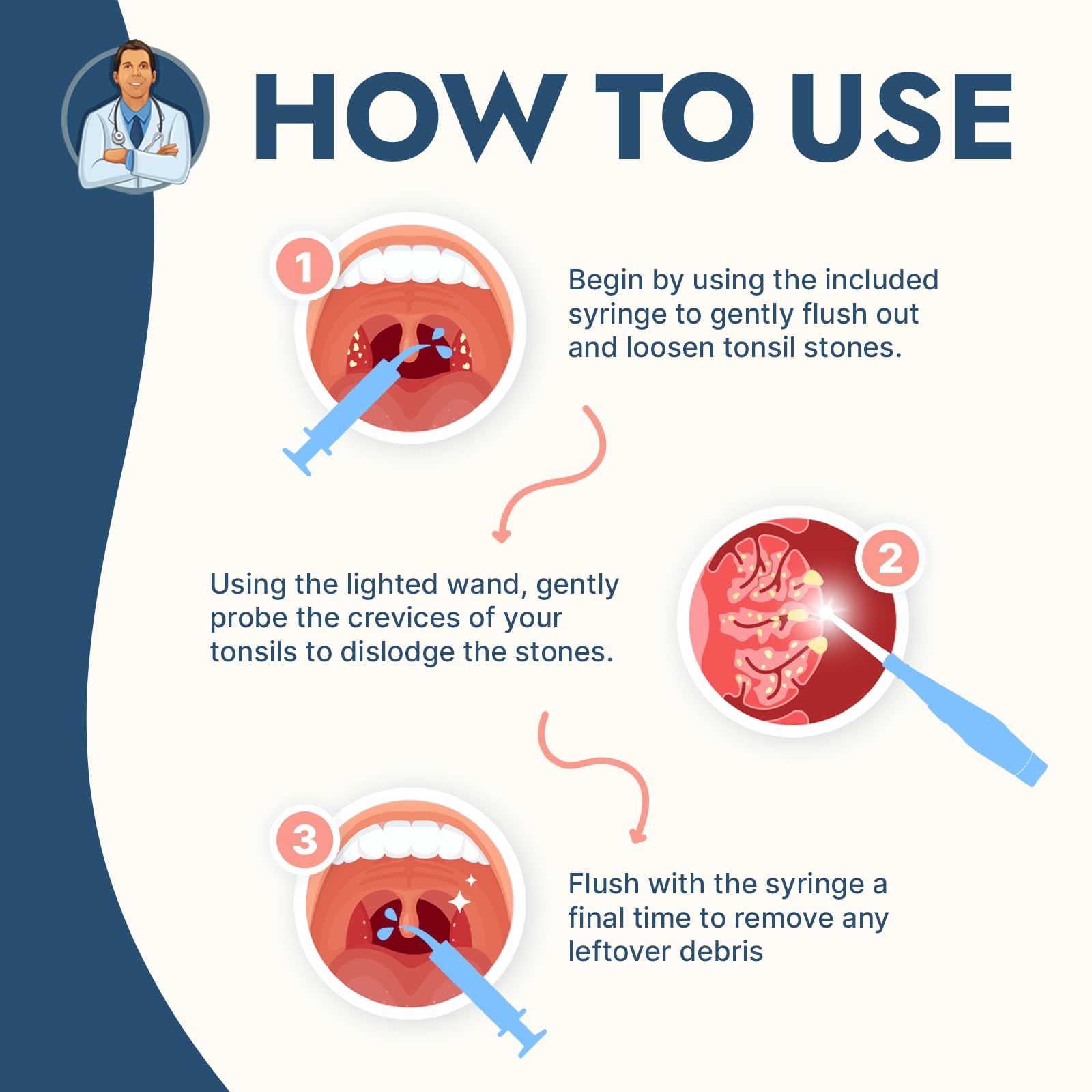Dr. Frederick’s Original Easy Tonsil Stone Remover Kit - Fast Painless ...