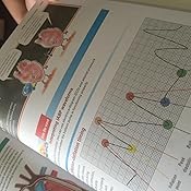 Hemodynamic Monitoring Made Incredibly Visual Incredibly Easy Series ...