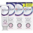 Amazon.com : Crest Pro-Health Gum and Sensitivity, Sensitive Toothpaste ...