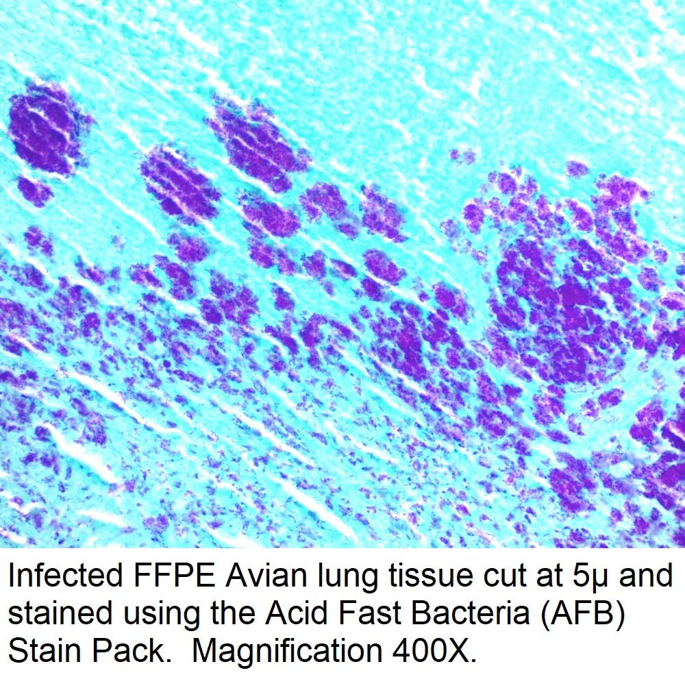 Acid Fast Bacteria (AFB) Stain Pack, 500ml on Galleon Philippines